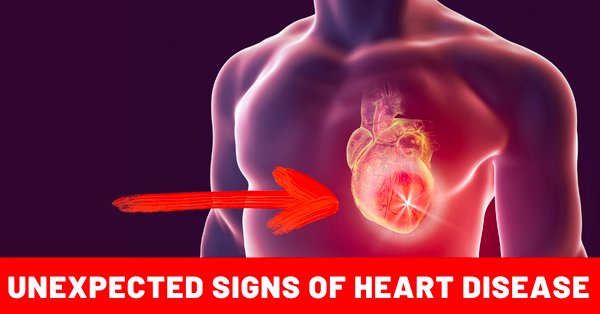 6 UNEXPECTED Signs of Heart Disease THAT YOU MUST KNOW | Curious Mob